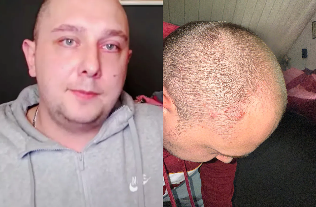 Daniel Magical błaga o pomoc! Co się dzieje z jego głową?! - 4INflu.pl ...